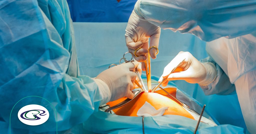Ureteroenteric stricture: Advanced reconstructive solutions following ...